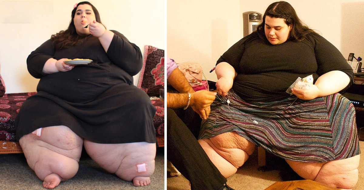 "Pesaba 300 kg a los 28 años". La chica que perdió 200 kg se transformó en una belleza que el ...