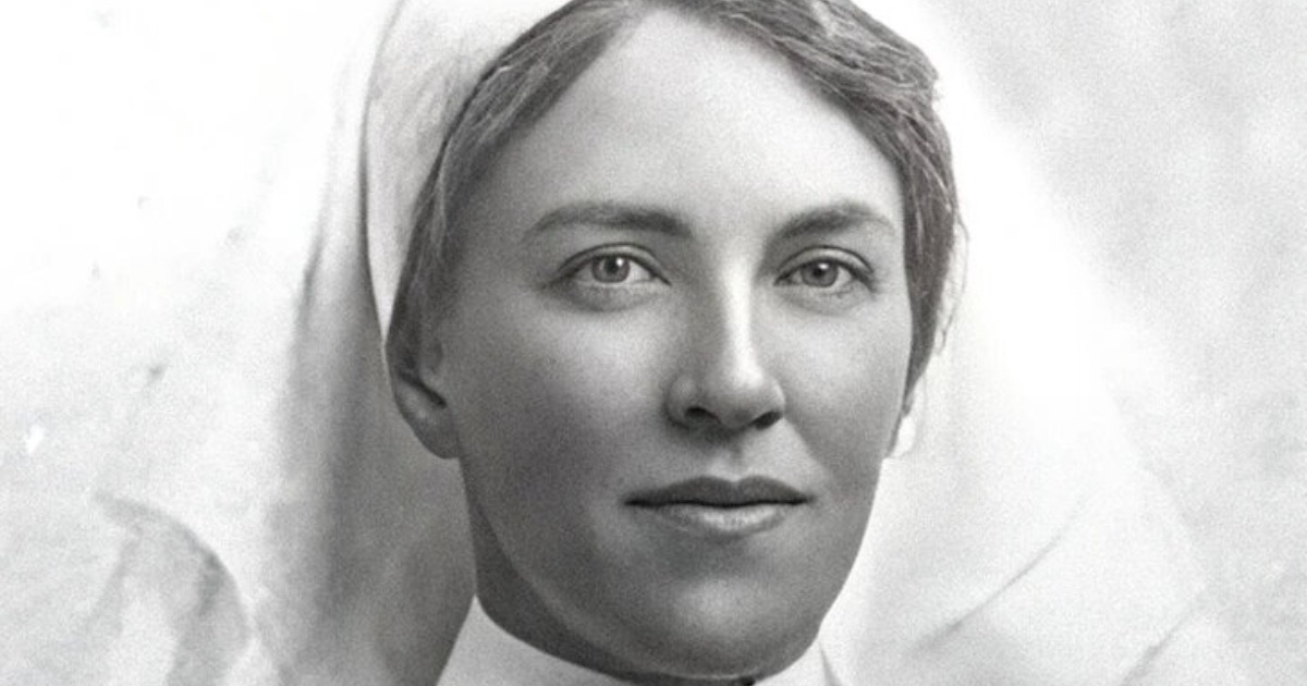 La tragedia de la hermosa Mary Ann: una enfermedad la desfiguró ...